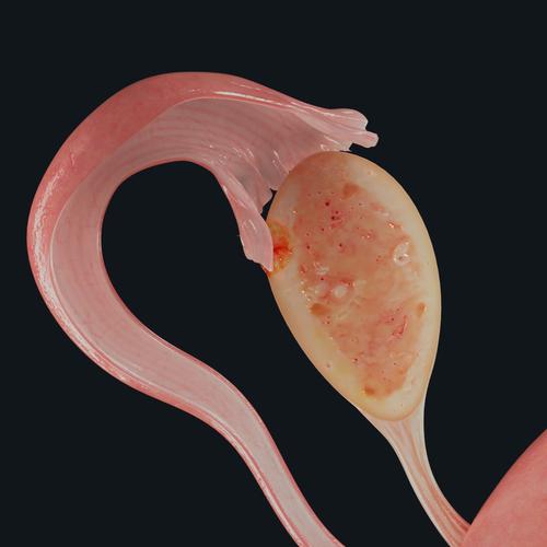 Menopause Definition & Anatomy: A Comprehensive Guide by Jennifer Davis ...