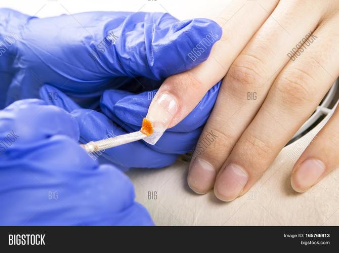 How to Stop Itchy Fingers After Gel Nails - Menopause Mastery